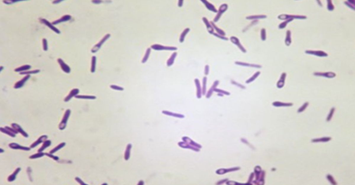 Necrotic Enteritis in Pigs - The Disease | Huvepharma
